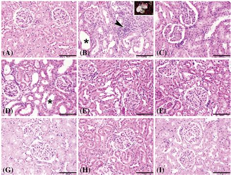 Representative Photomicrographs Of Renal Tissues From Male Rats Stained