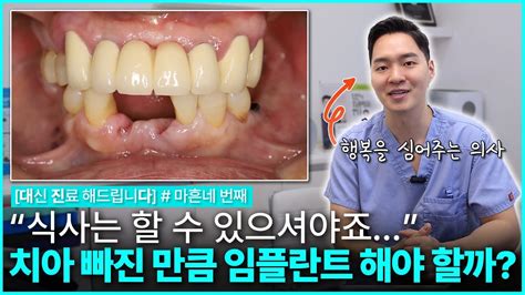 [대진다] 음식을 씹는 행복이 얼마 만인지 │당일 임플란트 당일 임시치아 임플란트 뼈이식 앞니 임플란트 어금니
