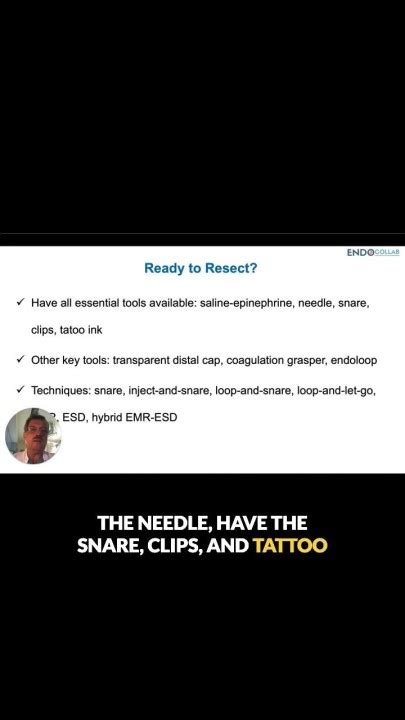 Klaus Mönkemüller On Linkedin Look At The Polyp Investigate It Interrogate It Clean It And