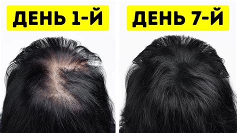 Я отрастила густые волосы всего за неделю Youtube
