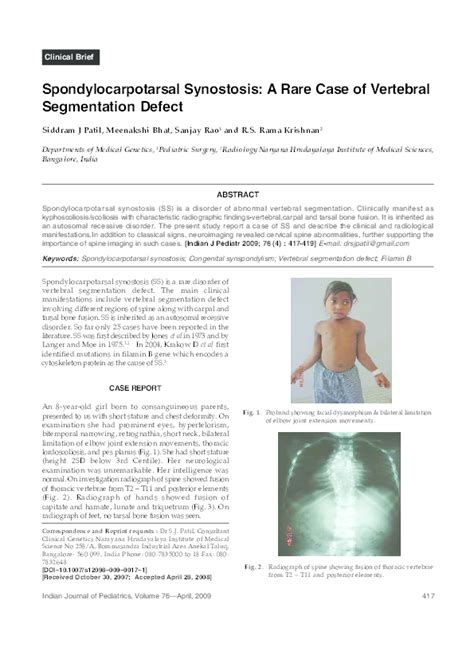 Pdf Spondylocarpotarsal Synostosis A Rare Case Of Vertebral Segmentation Defect