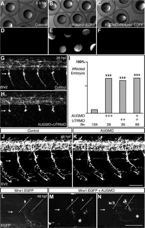 Notum 2 Knockdown Causes Cap Axon Truncation Zebrafish Embryos At 55