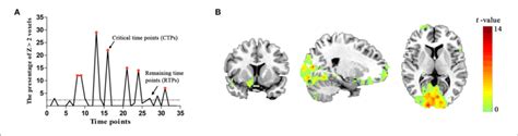 A The Spontaneous Brain Activity Pattern From A Participant The Download Scientific