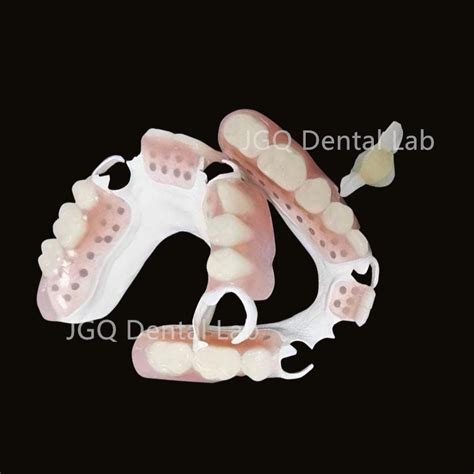 Removable Denture Partial Framework Flexible Hpp Peek Dental Lab