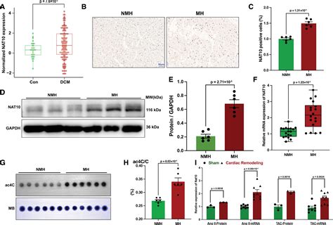 Nat10 Is Involved In Cardiac Remodeling Through Ac4c Mediated