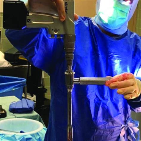 Angled Reamer Used To Avoid Violation Of Itb Tendon Image Courtesy Dr