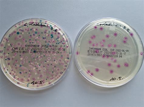 Multidrug Resistant High Risk Clonal Escherichia Coli Lineages Occur