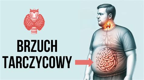 Brzuch Tarczycowy Przyczyny Objawy I Strategie Leczenia Motywator