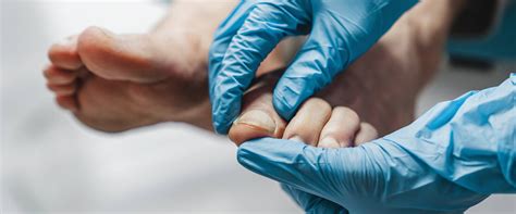 Fungal Skin Infections