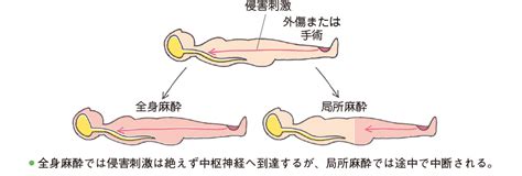 硬膜外投与と静脈投与ではどちらが疼痛緩和に有効？ 看護roo カンゴルー
