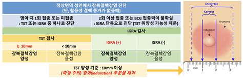잠복결핵 메디톡