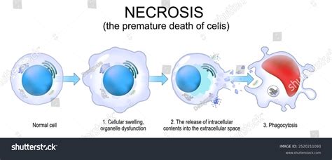 Necrosis Premature Uncontrolled Cell Death Cell Stock Vector Royalty Free 2520211093