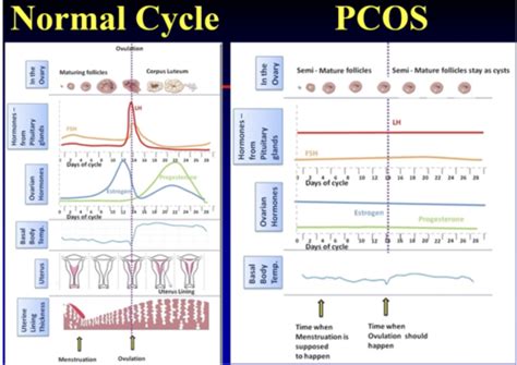 5 Pcos Flashcards Quizlet