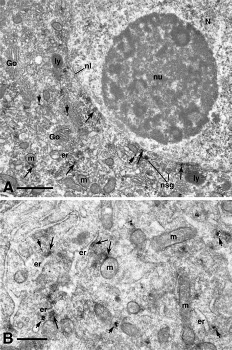 Cell Bodies Of Neurosecretory Neurones Of The Supraoptic Nucleus