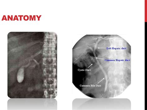 Cholangiogram Meaning