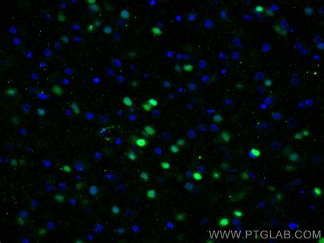Sox2 Antibody 66411 1 Ig Proteintech