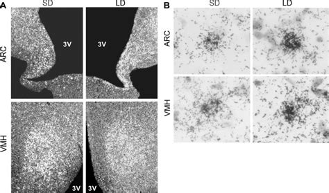 Representative Dark Field Micrographs A 2 Magnification And