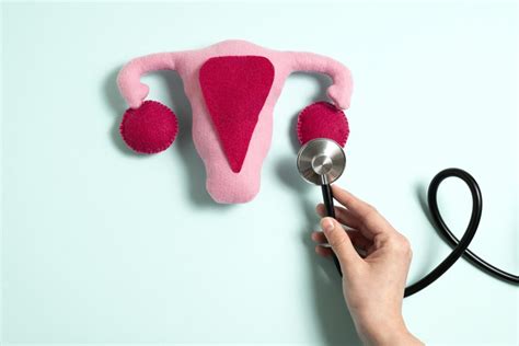 Hipermenorrea Dismenorrea Y Amenorrea Alteraciones Menstruales