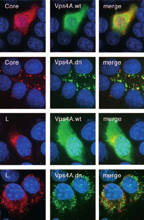 Dn Vps4a Redistributes Hbv Core And L To Aberrant Endosomal Class E Download Scientific Diagram