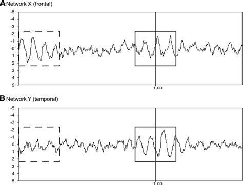 Example Of Time Series Of The Frontal And Temporal Network The Square