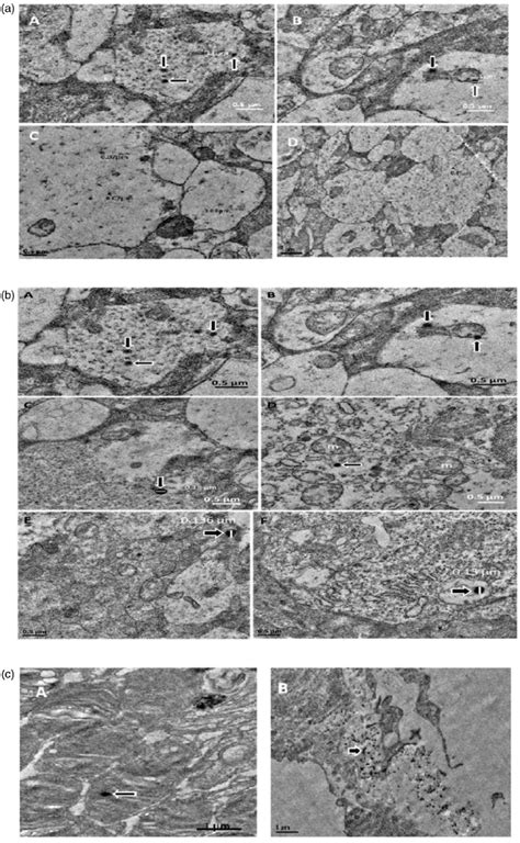 Presence Of Slns In Inner Plexiform Layer Of Retina Arrows Marked On Download Scientific