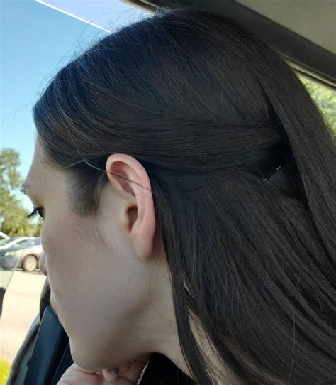 Side Profile Brow Bone Insecurities 32f How To Improve R