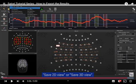 Tutorial Video Series Take Your Research To The Next Level With Satori Nirx Fnirs Systems