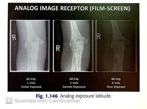 Positioning I Ch 1 Analog Radiography Image Quality Flashcards Quizlet
