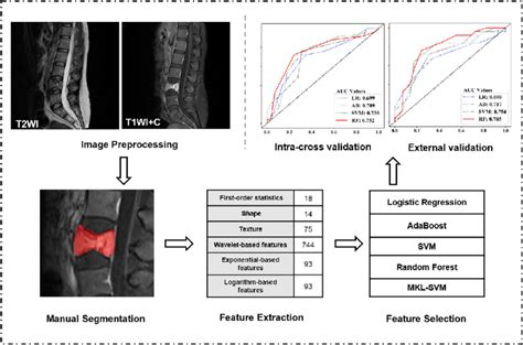 The Radiomics Workflow Download Scientific Diagram
