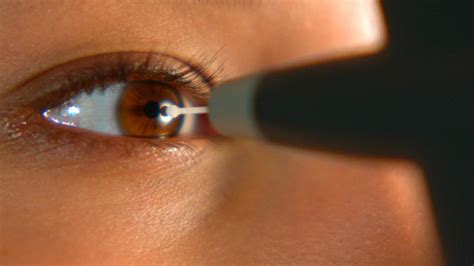 Glaucoma La Silenciosa Enfermedad Ocular Que Deteriora La Visión Para Siempre Infobae