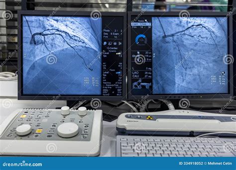 Istanbul Turkey 28 February 2024 Angiogram Sequence Working Clockwise