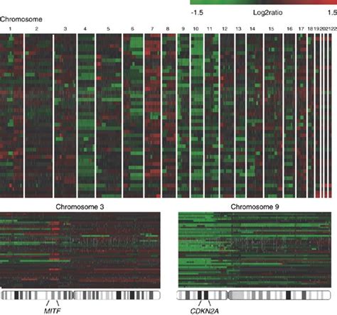 Genomic Profiling Of Malignant Melanoma Using Tiling Resolution ArrayCGH Oncogene