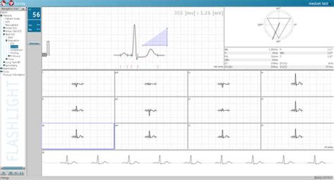 Analysis Software Medset Medizintechnik Measurement For Ecg