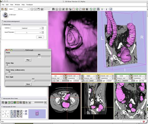 modules endoscopy documentation 3 6 slicer wiki
