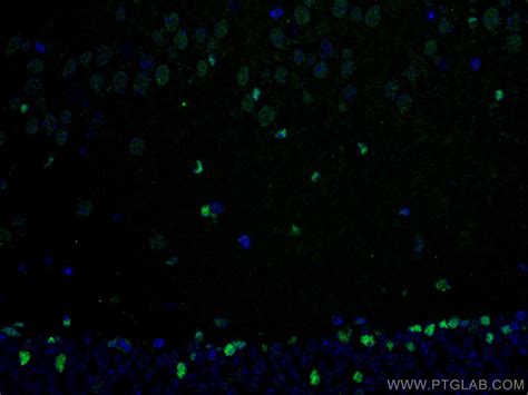 Zbtb20 Antibody 23987 1 Ap Proteintech