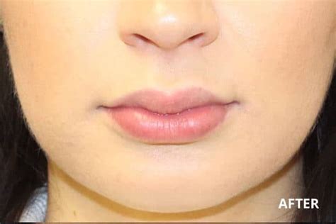Long Island Plastic Surgeon Best Nyc Plastic Surgeon Dr Madnani