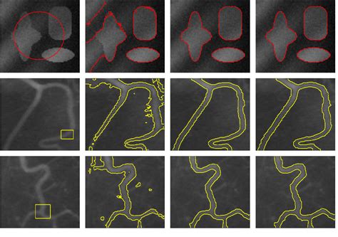 Figure 2 From An Active Contour Model And Its Algorithms With Local And