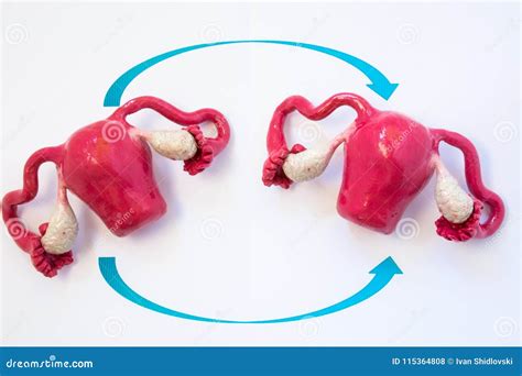 Het Conceptenfoto Van De Baarmoederoverplanting Twee Anatomische