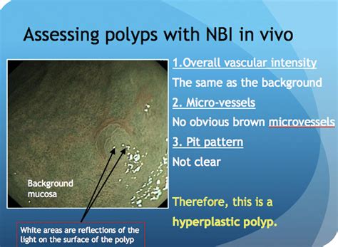 Development And Validation Of A Training Module On The Use Of Narrow