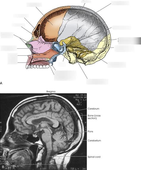 Lateral Aspect Of Interior Of Cranium Diagram Quizlet