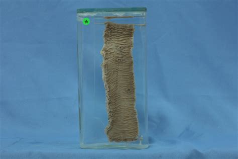 结核 93 86 肠结核