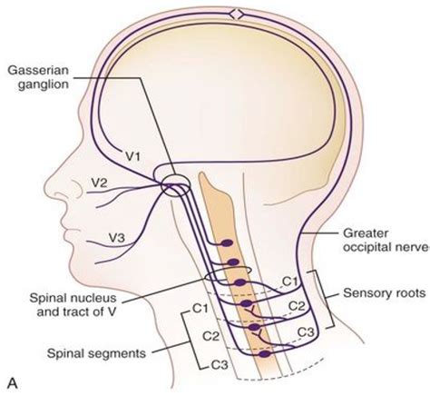 Headaches Flashcards Quizlet