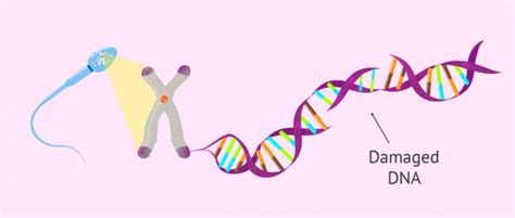 Sperm Dna Fragmentation Causes Treatment And Effect On Fertility