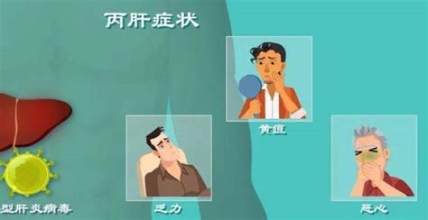 600万丙肝患者七成竟毫无征兆如何识别潜在杀手丙肝的隐匿征兆 腾讯新闻