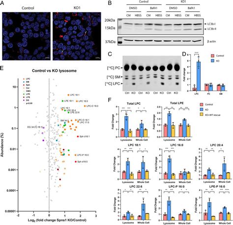 Spns1 Ko Cells Accumulate Lpc In Lysosomes A Live Cell Lysotracker