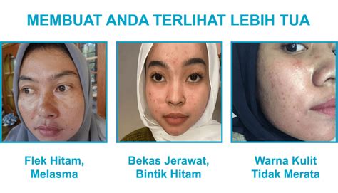 Devanti Skincare The Expert Of Skin Treatment