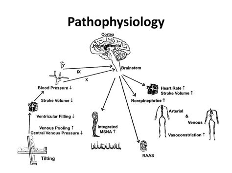 Approach To Syncope Patient In Ed Pptx