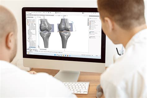 Effectiveness Of Computer Assisted Tka Compared With Traditional Tka