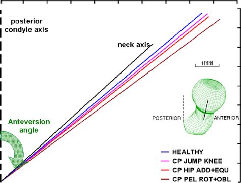 Growth Trajectory Of The 2d Femoral Anteversion Angle In Black The