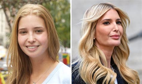 Ivanka Plastic Surgery